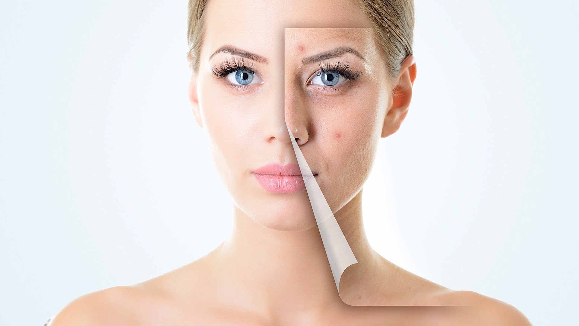 Acne Scars to Aging: How Microneedling is Solving North Texas’s Biggest ...